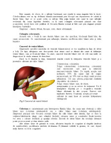 Anatomia Veziculei Biliare - Proiect - Anatomie #313502 | RegieLive
