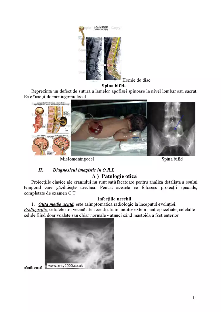 Patologie Articulară - Curs - Medicină #84402 | RegieLive
